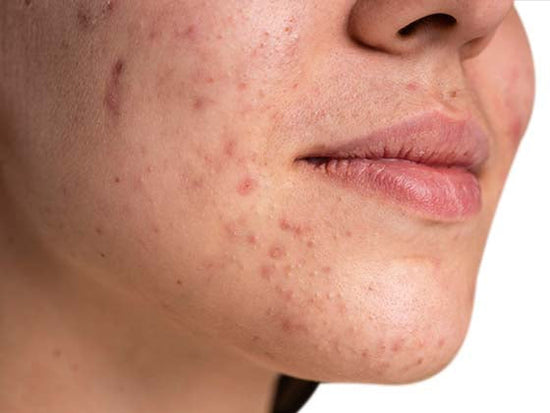 Our Derma Store – Ourdermastore